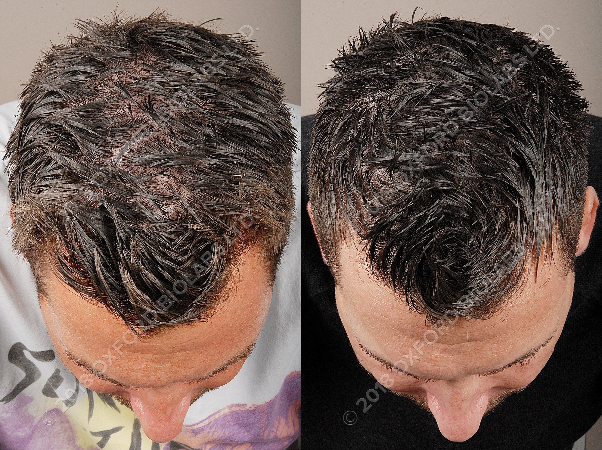 TRX2® Hair Revitalising Lotion - Oxford Biolabs