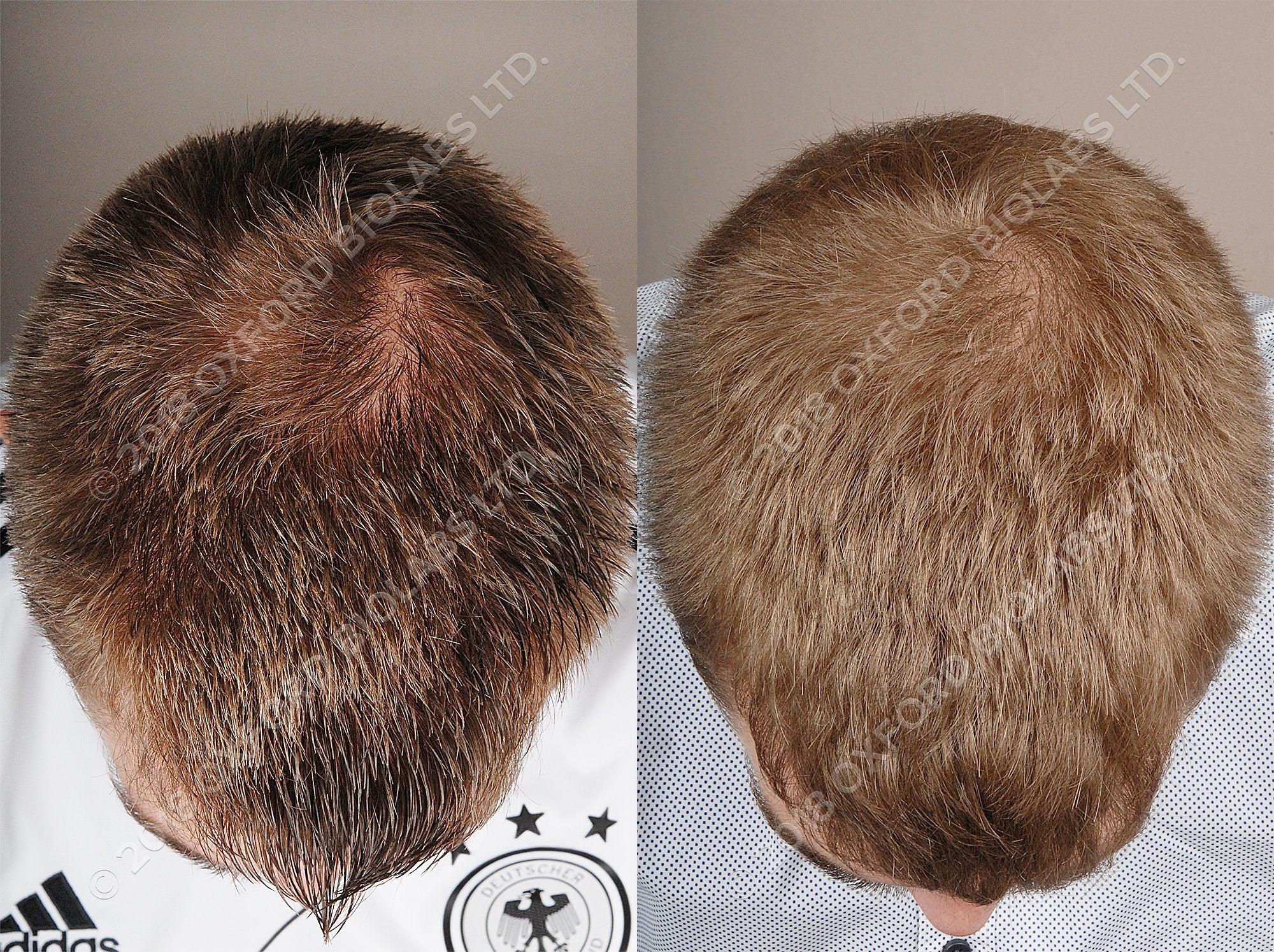 TRX2® Hair Revitalising Lotion - Oxford Biolabs